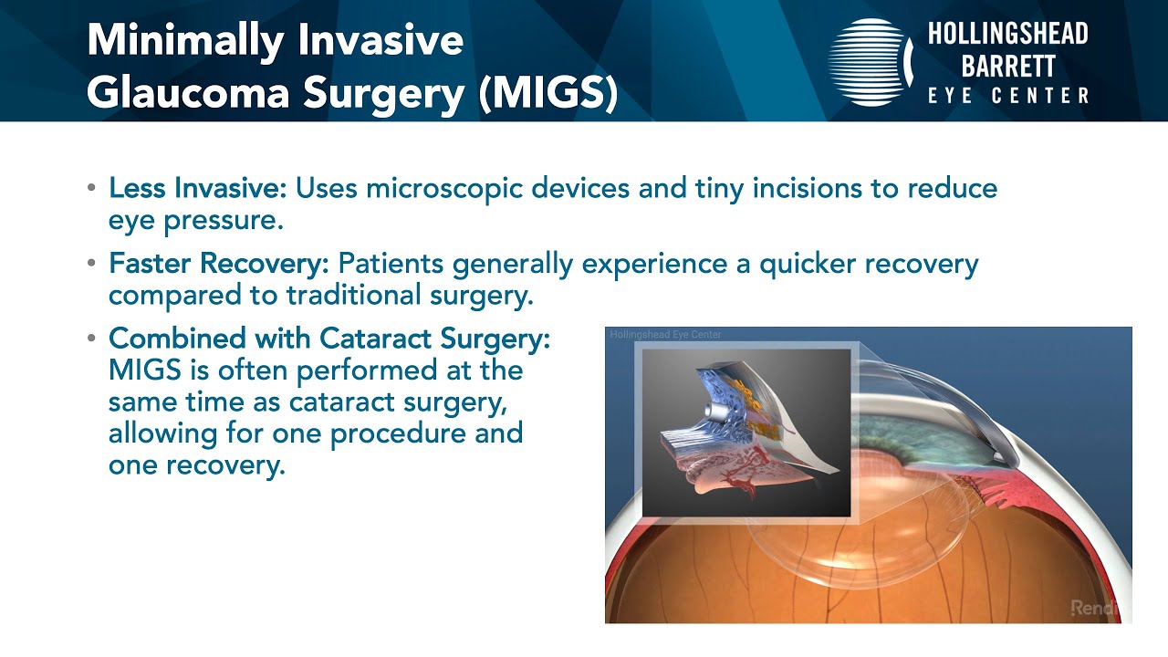 Minimally Invasive Glaucoma Surgery - Scott Woolf, MD - YouTube