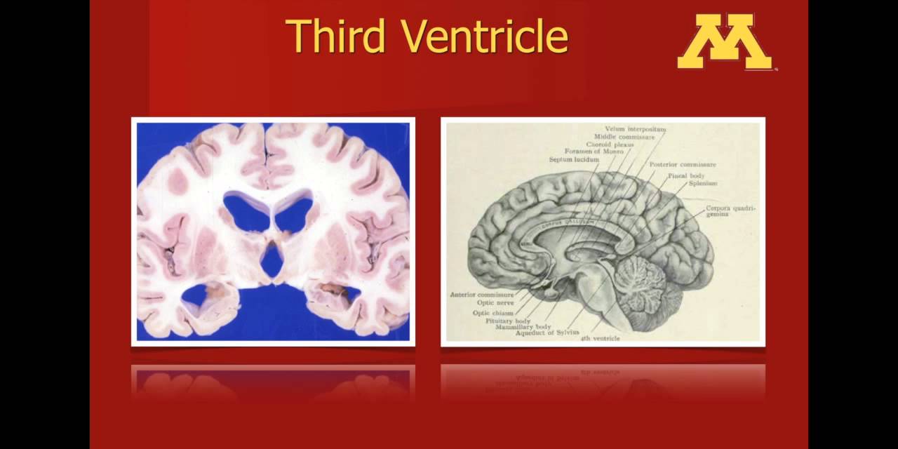CSF Made Simple (Part 1) - YouTube