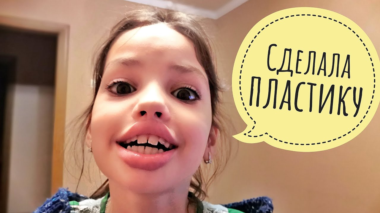 Glued lip challenge. Прикол из Лайка. Пластическая хирургия губ у себя ...