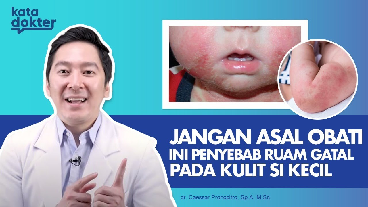 Jangan Asal Obati, Ini Penyebab Ruam Gatal Pada Kulit Si Kecil! | Kata ...