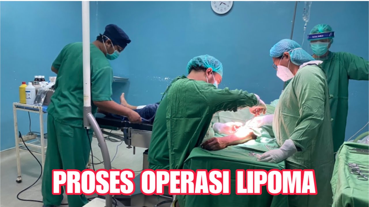 PROSES OPERASI LIPOMA ( TUMOR JINAK ) - YouTube
