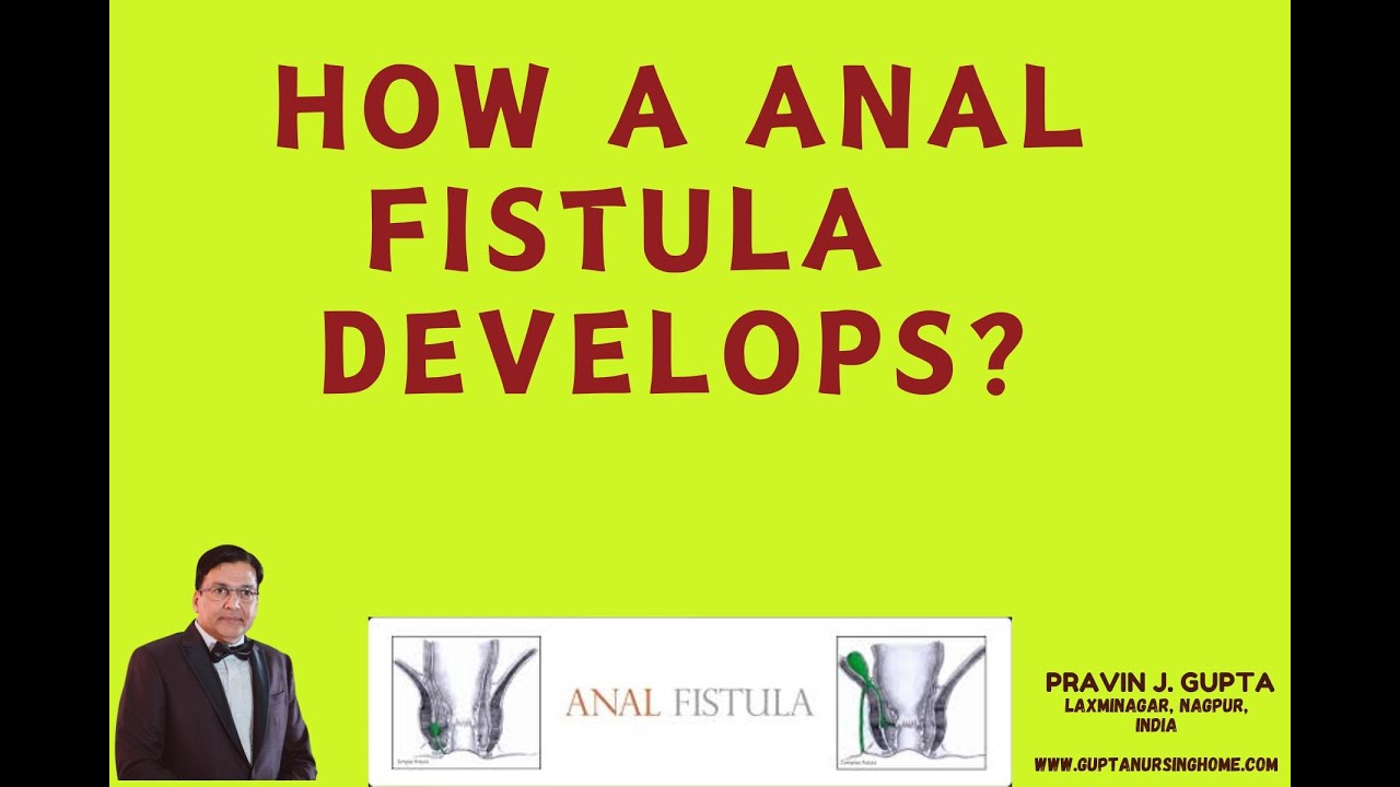 HOW ONE DEVELOPS AN ANAL FISTULA? - YouTube