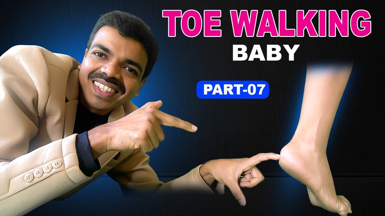 TOE WALKING in babies: Amazing Before and After Treatment Results Dr ...