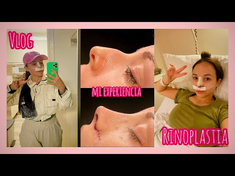 Mi EXPERIENCIA haciéndome una RINOPLASTIA👃🏼💖 