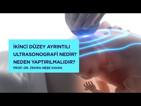 İkinci Düzey Ayrıntılı Ultrasonografi Nedir? Neden Yaptırılmalıdır?  - Prof. Dr. Zehra Neşe Kavak