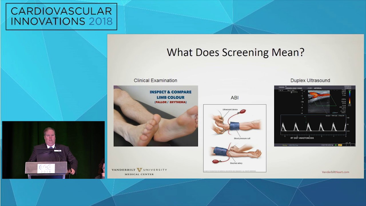 CVI2018 Session: How I follow-up my patients post revascularization ...