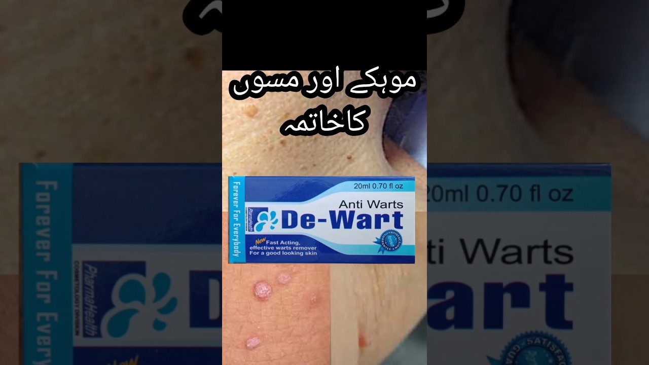 Use of De-wart lotion, How remove skin warts, skin tags #skintags # ...