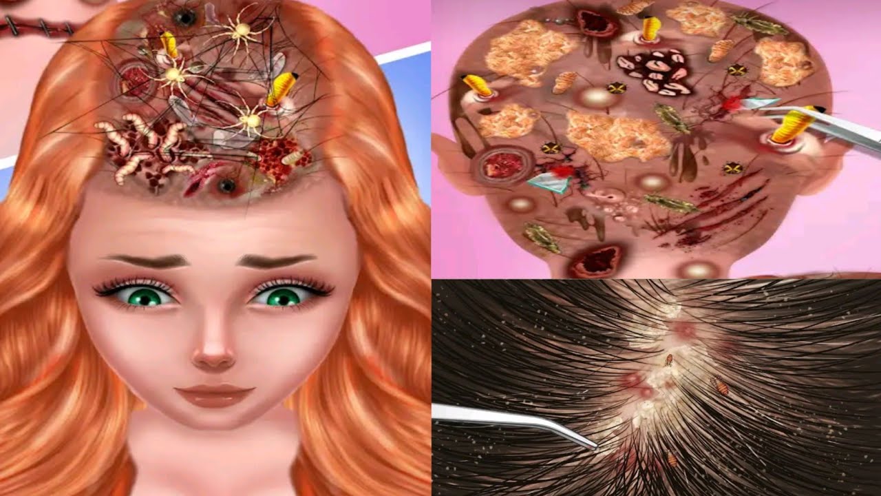 ASMR hair fall cleaning & pimple removal animation - YouTube