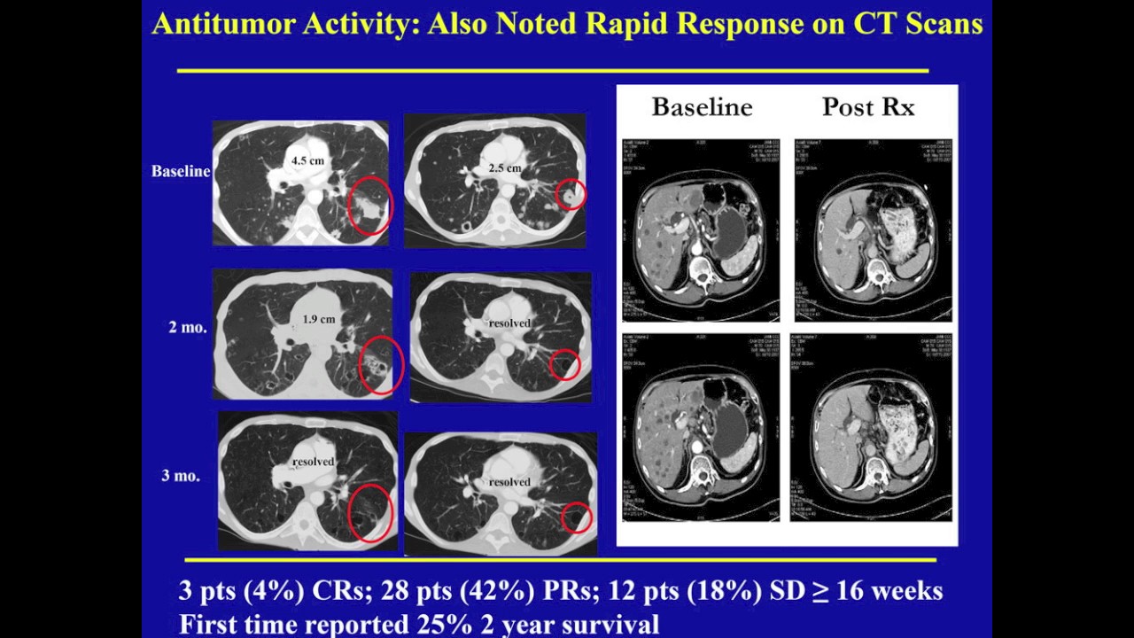 Pursuing The Scar: 2016 State of Pancreatic Cancer Dr, Daniel Von Hoff ...