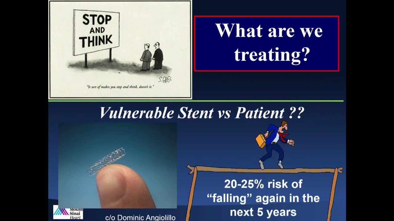 Antiplatelet Therapy Post PCI - Roxana Mehran, MD - YouTube