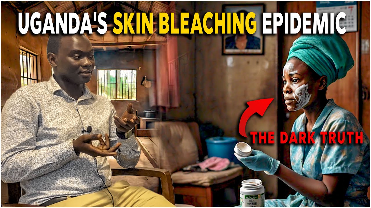 Dark Secrets of Skin Color Discrimination in Africa - YouTube