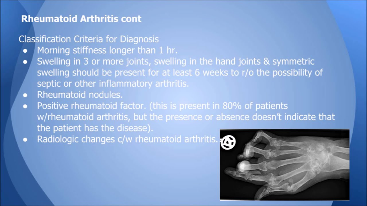 Rheumatologic Disorders - YouTube