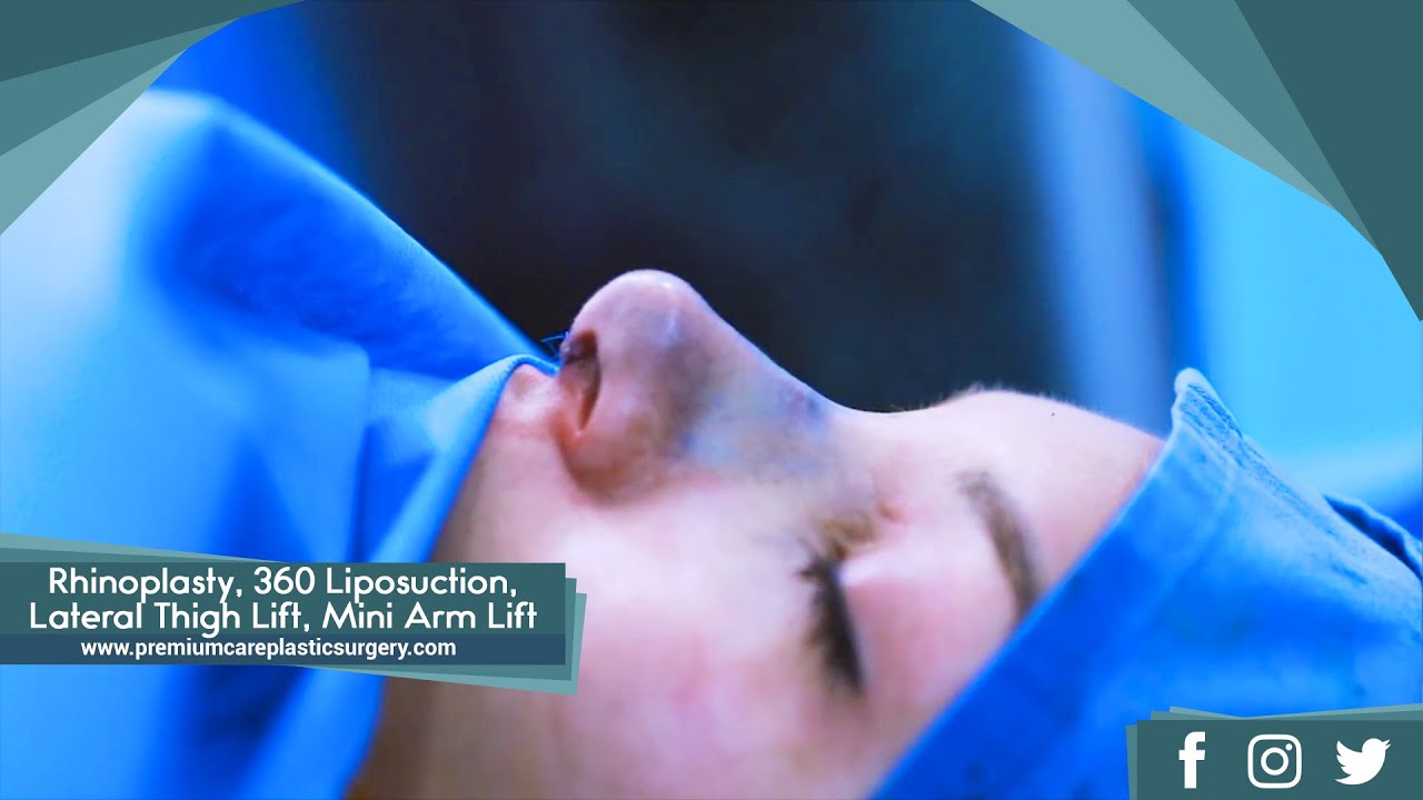 Rhinoplasty, 360 Liposuction, Lateral Thigh Lift, Mini Arm Lift - YouTube