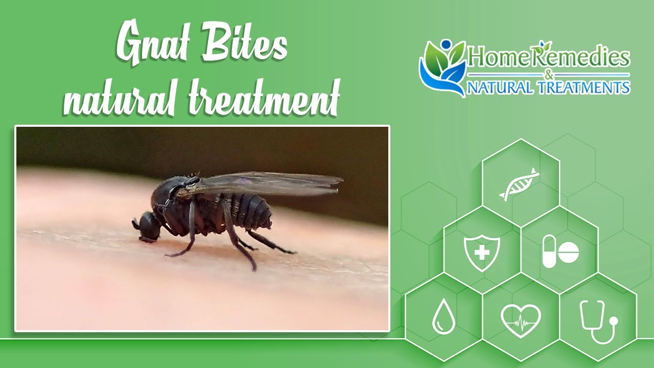 Natural treatments and home remedies for gnat bites. - YouTube