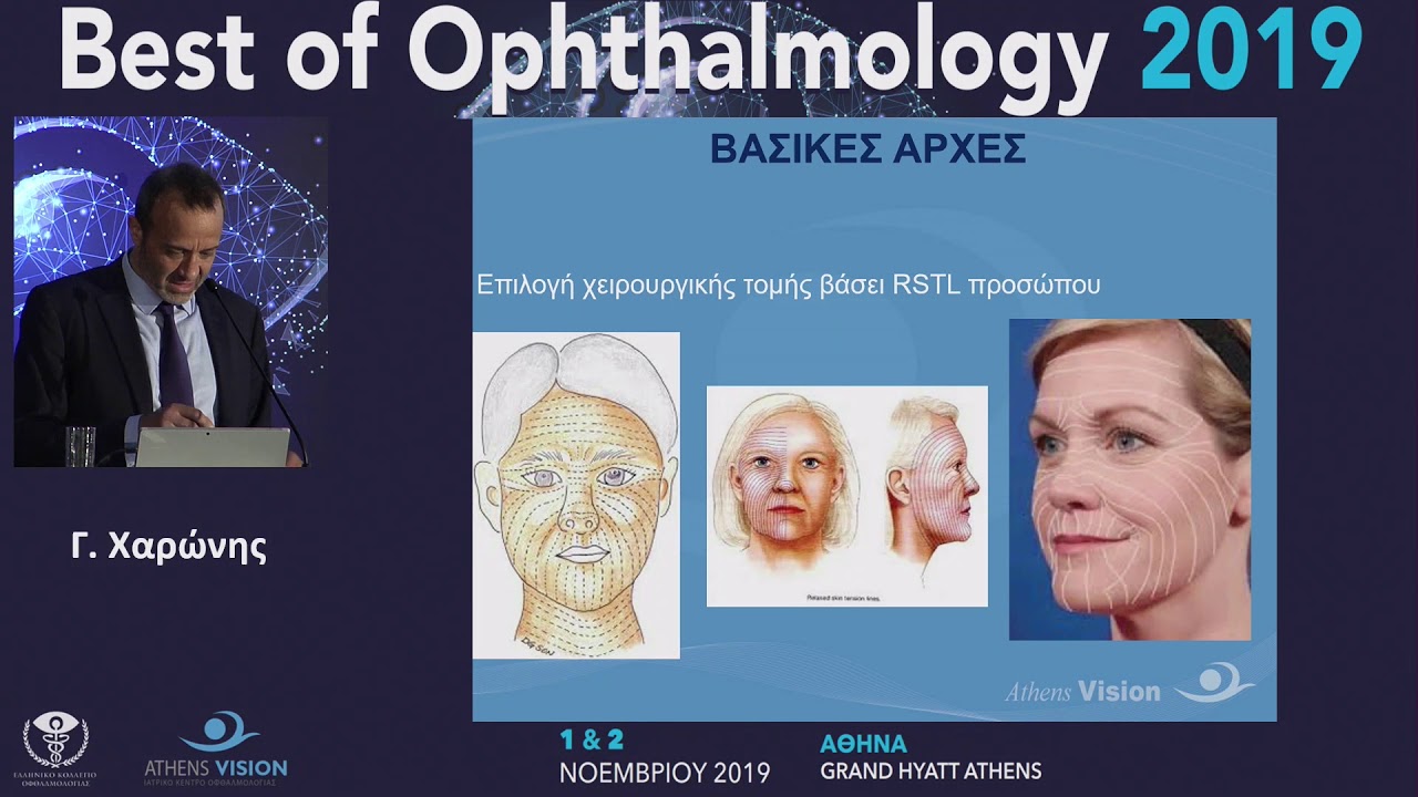 Best of Ophthalmology 2019 | 1η Ομιλία Γ. Χαρώνη - YouTube