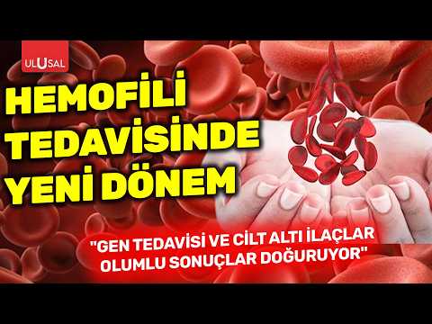 Hemofili tedavisinde yeni dönem: “Gen tedavisi ve cilt altı ilaçlar olumlu sonuçlar doğuruyor”
