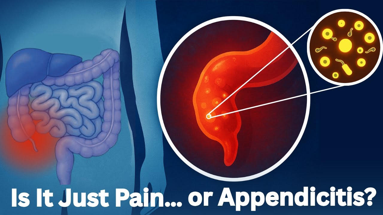 Appendicitis Explained: Causes, Symptoms & Treatment | Simple Health Guide - YouTube