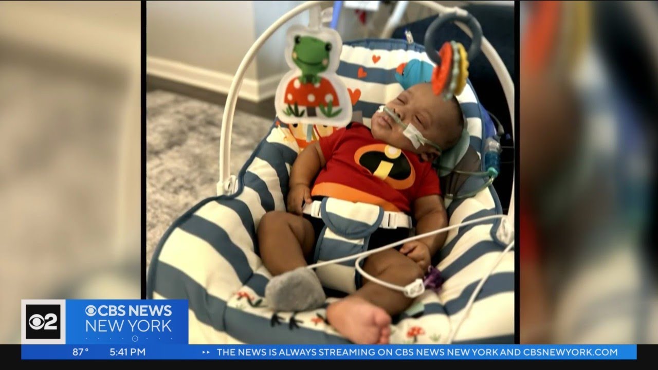 Baby in Pennsylvania receives smallest pacemaker in the world - YouTube