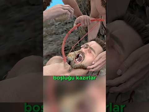 Anestezi Olmadan Diş Delme🦷⛏️😖😬