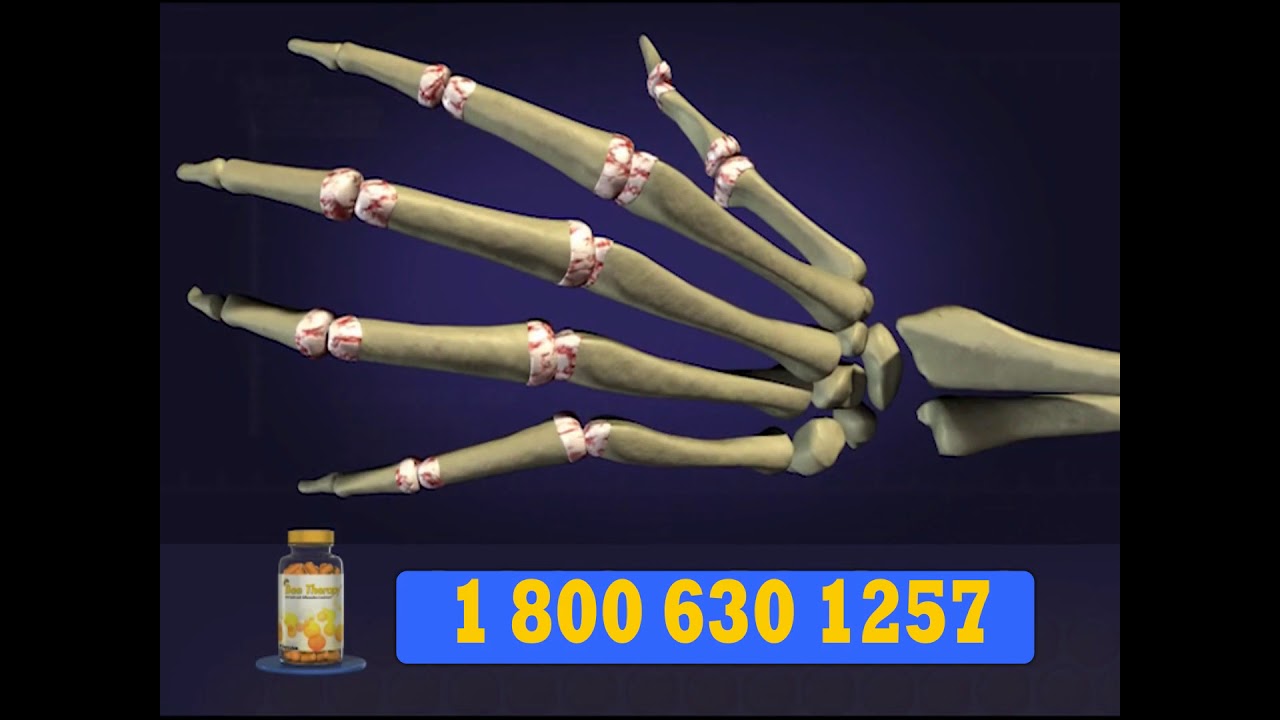 Bee Therapy - YouTube