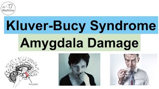 Kluver-Bucy Syndrome | Causes Pathophysiology Signs u00... | Doovi