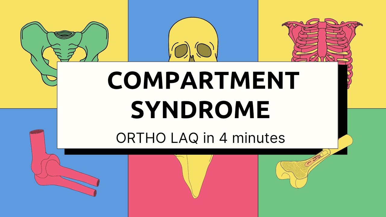 COMPARTMENT SYNDROME Ortho LAQ explained in 2 minutes - YouTube