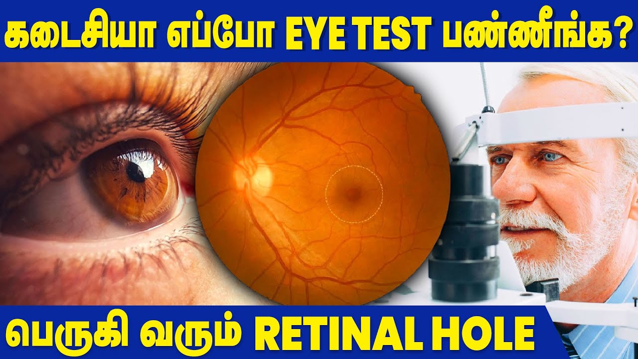 Retinal Holes - Causes, Symptoms and Preventive Measures - YouTube