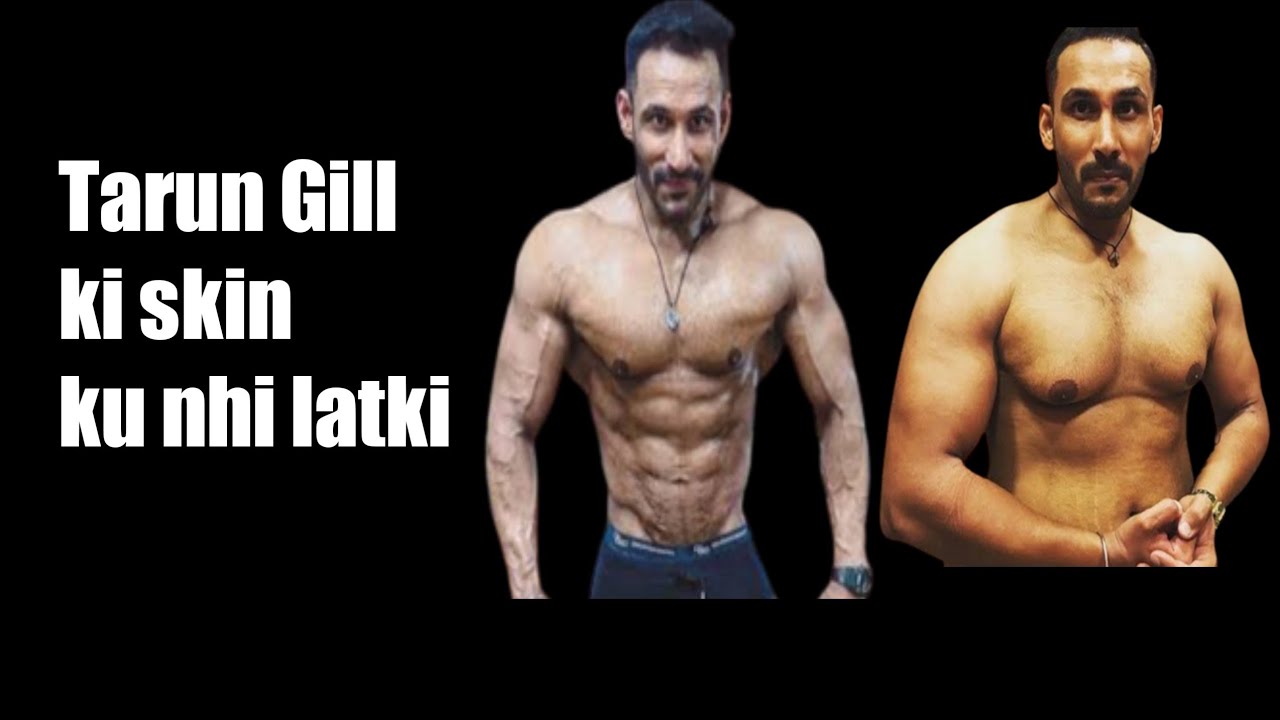 Tarun Gill ki Skin ku nhi latki ||Tarun Gill Transformation|| BR ...