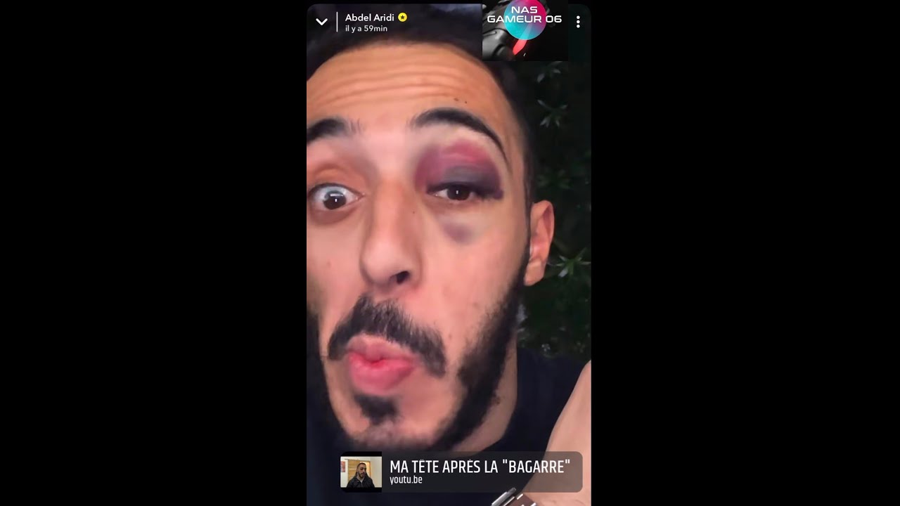 GAMEMIXTREIZE ŒIL AU BEURRE NOIR ! - YouTube