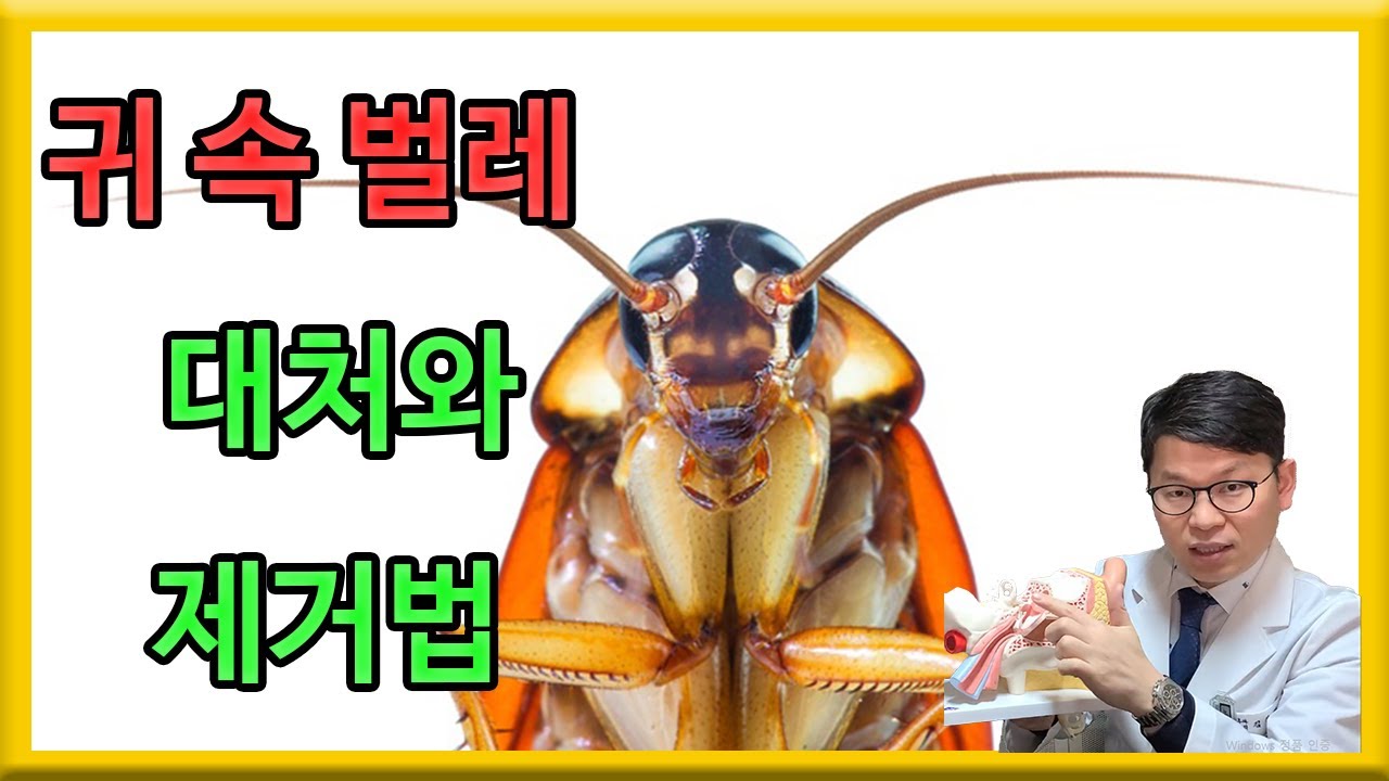 귀에서 벌레 빼기 | 귀에 벌레 들어 갔을때 대처법 | ear insect removal | insect in the ear ...
