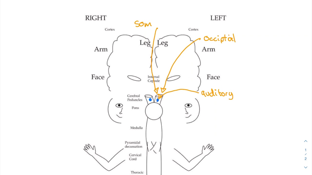 The TECTOSPINAL TRACT (simple) - YouTube