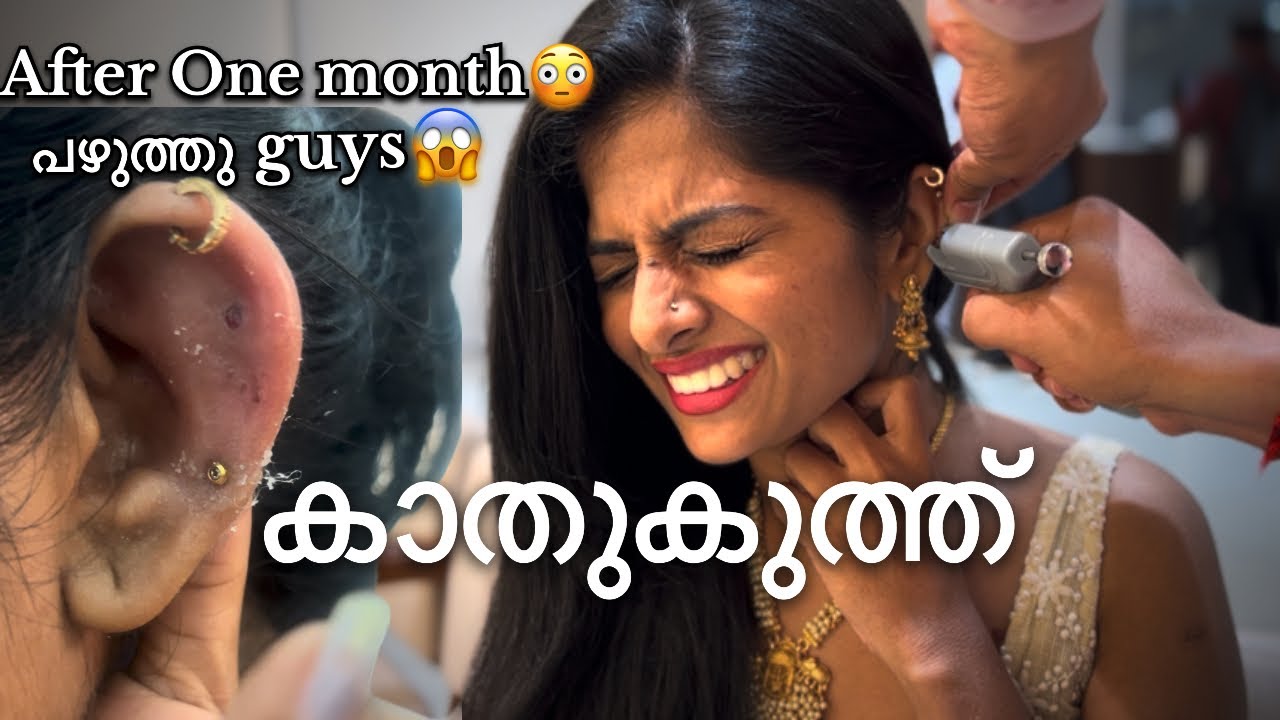 Ear Piercing Gone wrong കമ്മൽ കളയാതെ Recover ചെയ്യാം🥰#trending #love # ...