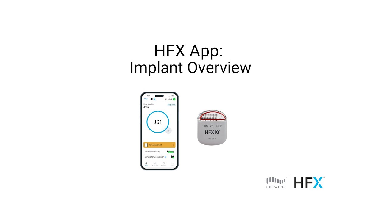HFX App Overview for your HFX Implant - YouTube