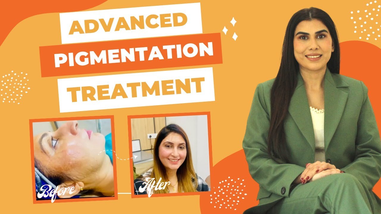 The Amazing Long Term Results for a Flawless Skin | Dt Gagan Sidhu ...