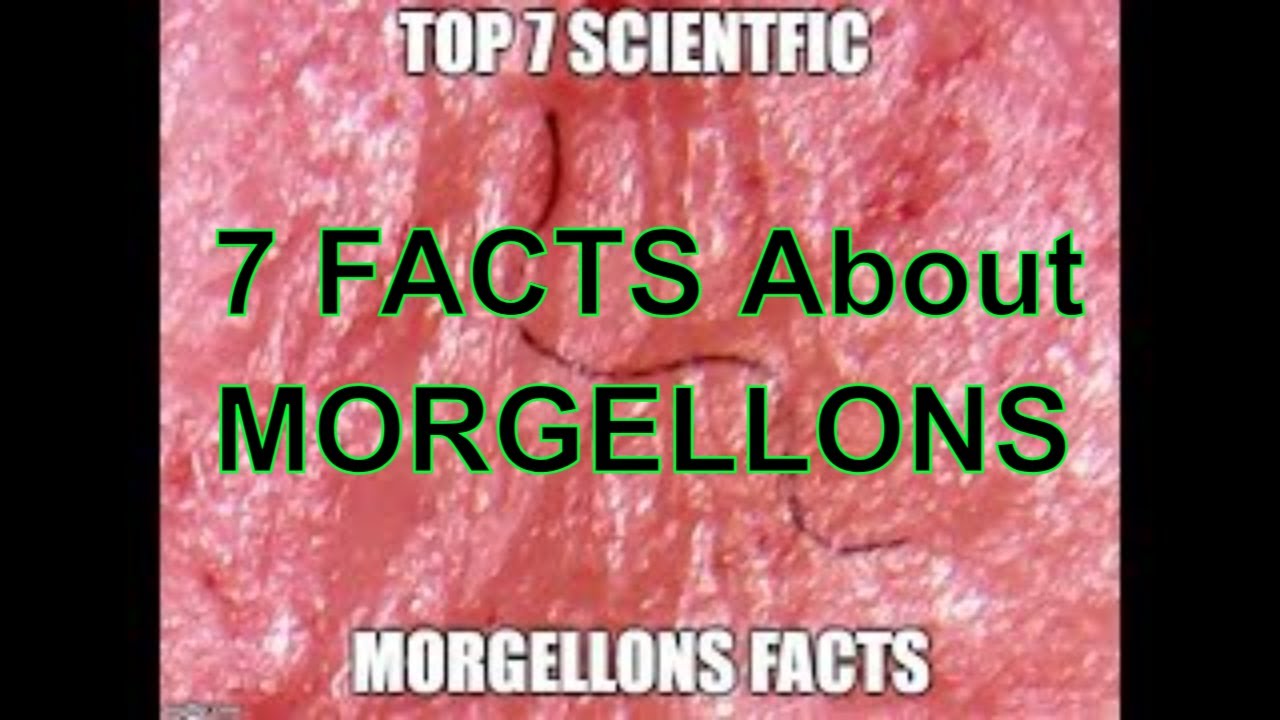 Top 7 Scientific Morgellons Facts - YouTube