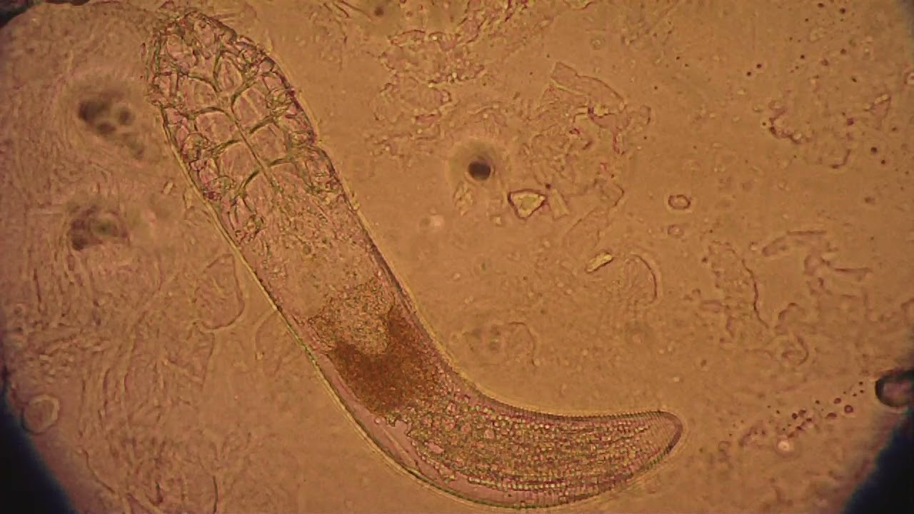 Demodex folliculorum mite under a microscope walking - YouTube