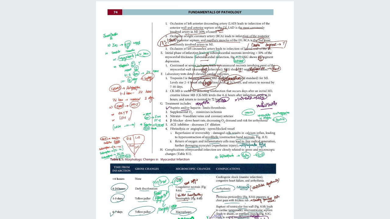 MYOCARDIAL INFARCTION | CARDIAC PATHOLOGY PATHOMA - YouTube