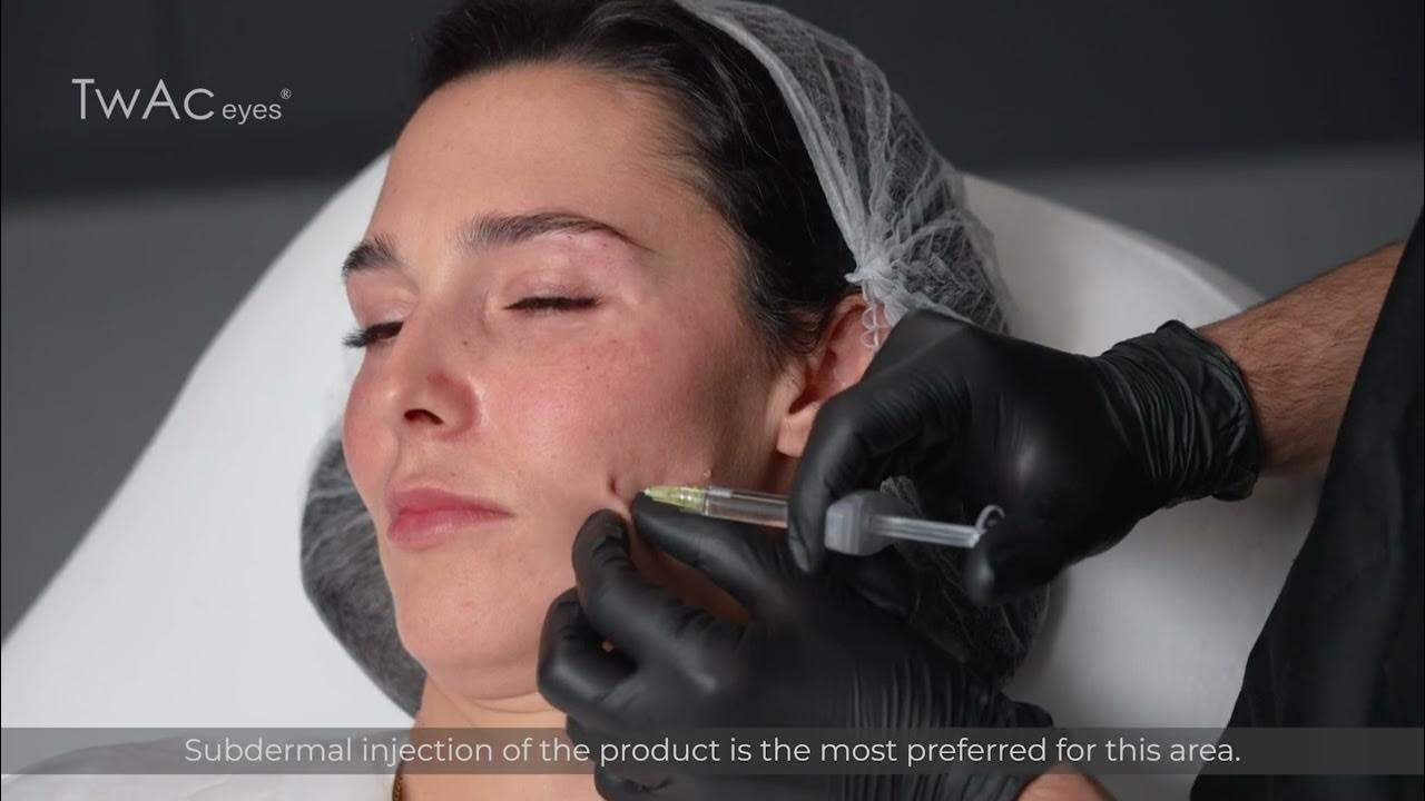 TwAc Eyes using in the lower third of the face - YouTube