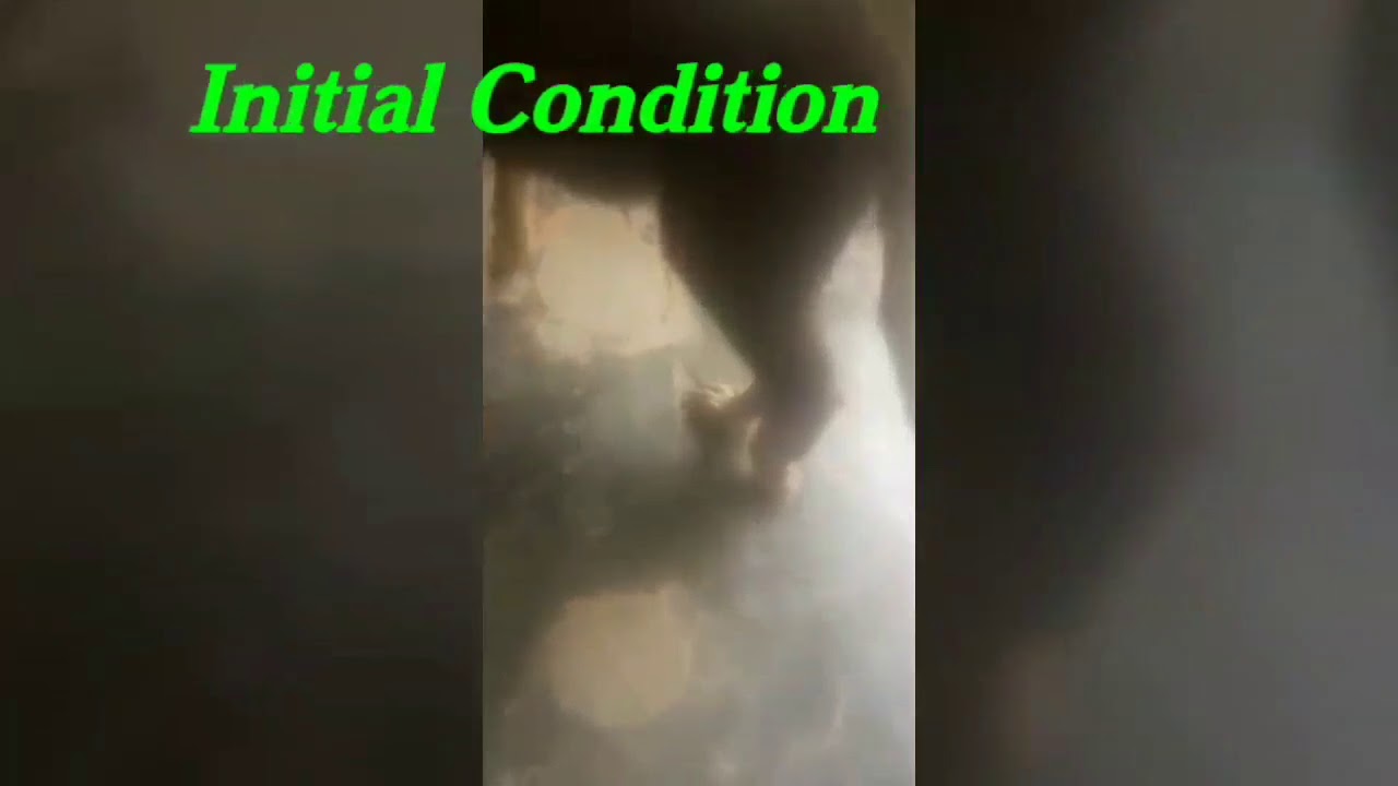 Surgical Management of supracondylar/distal end fracture of femur ...