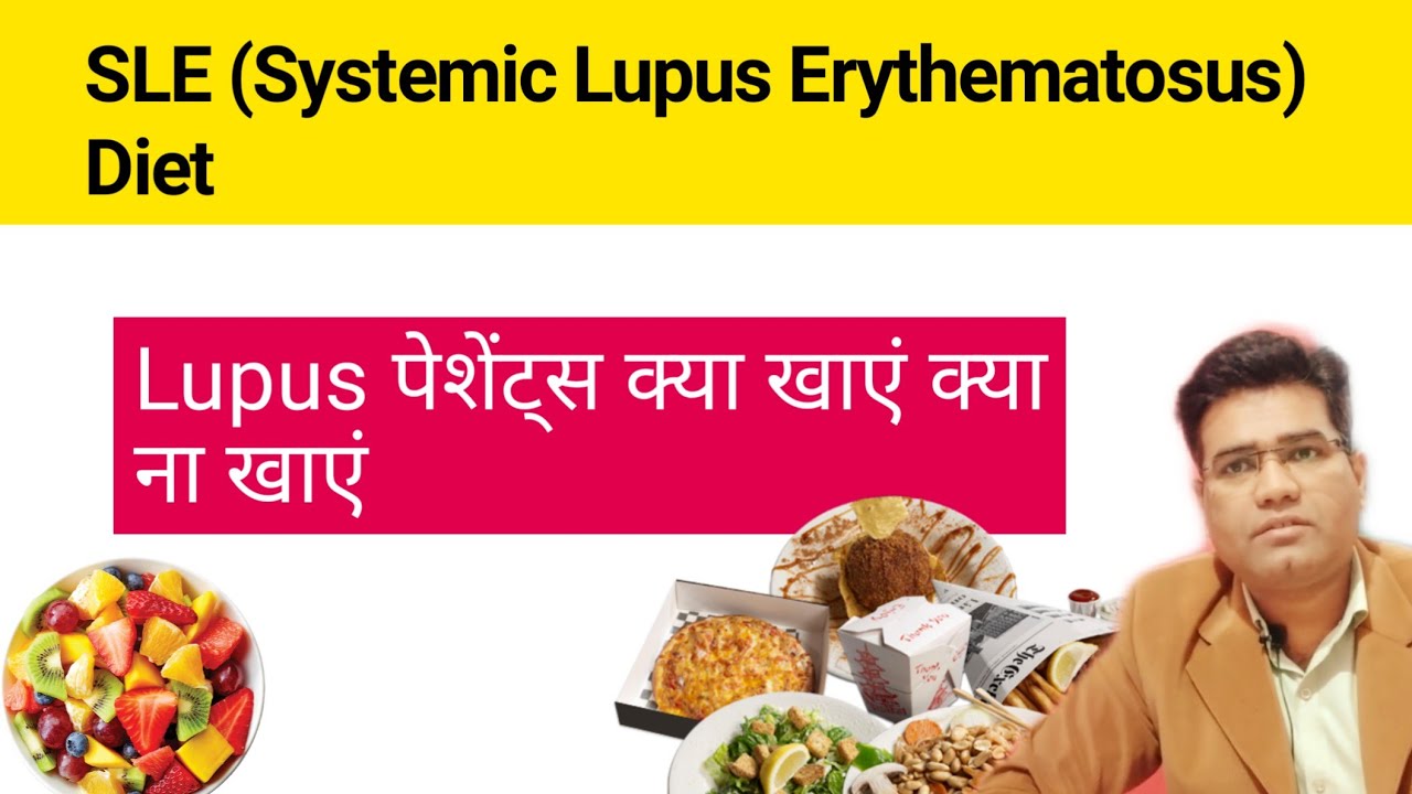 Diet For Sytemic Lupus Erythematosus Patients - Explained | SLE - YouTube