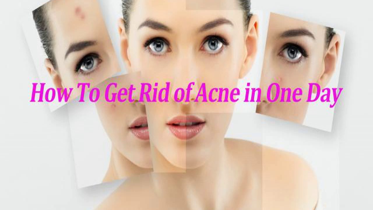 How to get rid of serious acne - YouTube