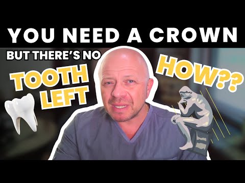 Can You Get A Crown If There Is No Tooth