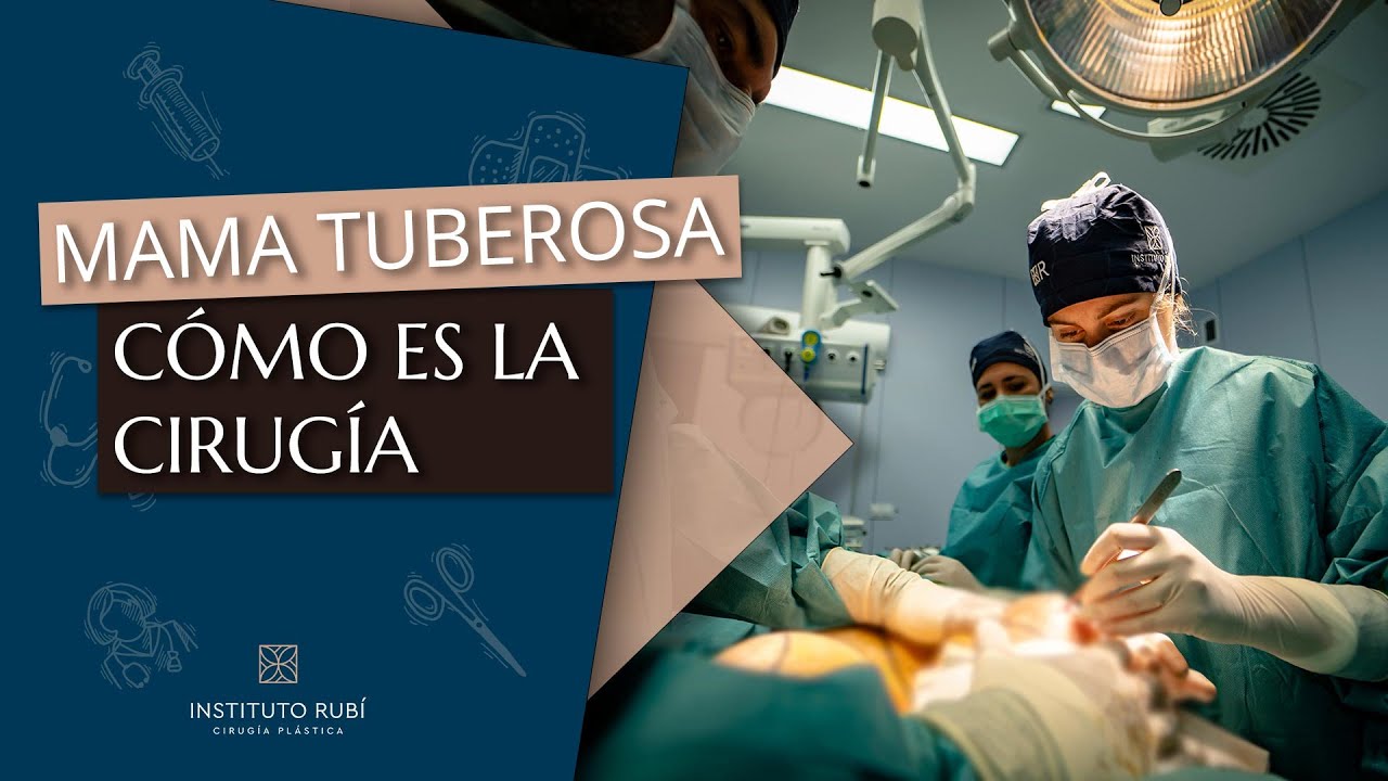 Cirugía plástica de mama tuberosa - YouTube