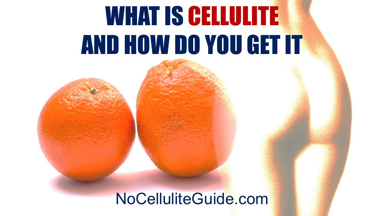 What is cellulite and How Is Cellulite Formed - YouTube