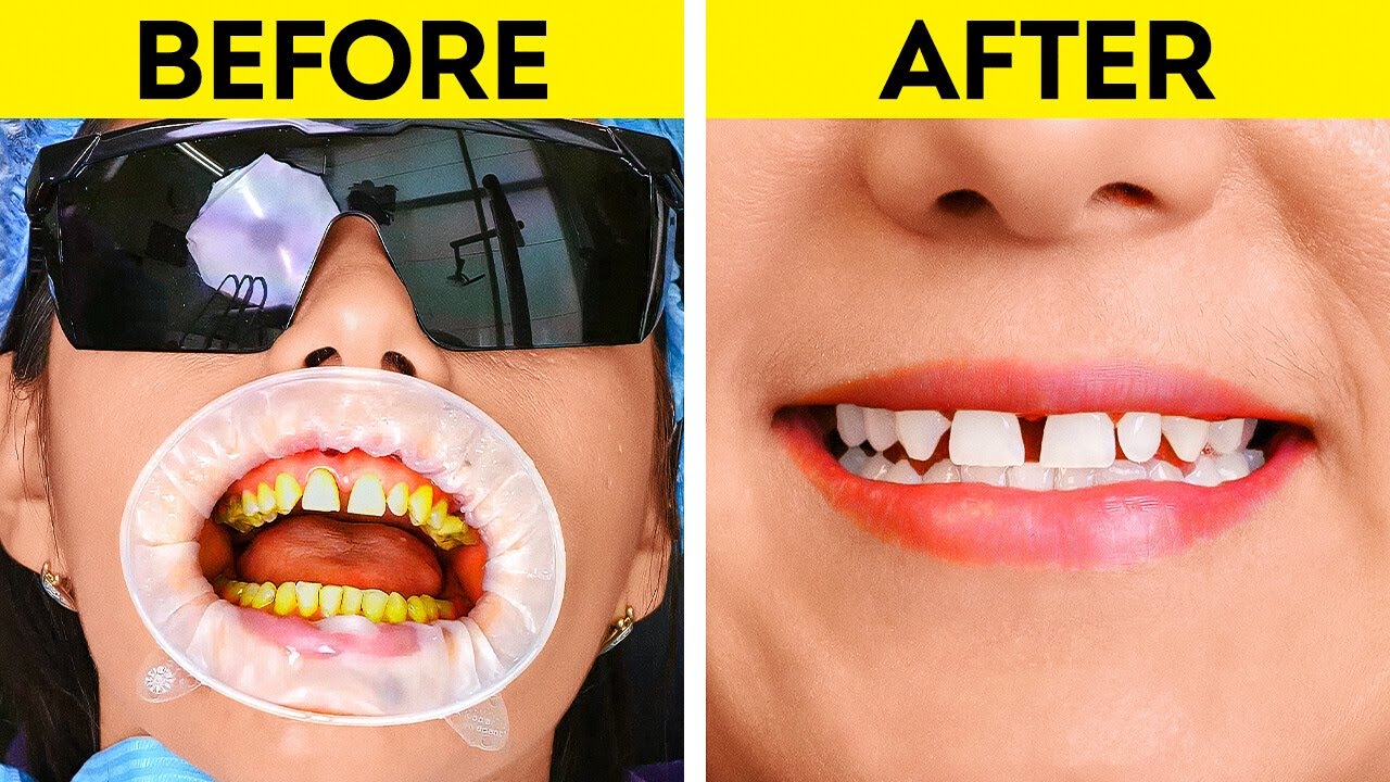 Dentist Gives Perfect Professional Teeth Cleaning - Watch The Magic ...