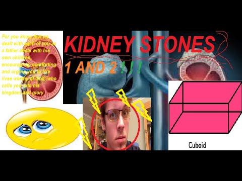 Kidney stones series 100% // I'm going crazy! - YouTube