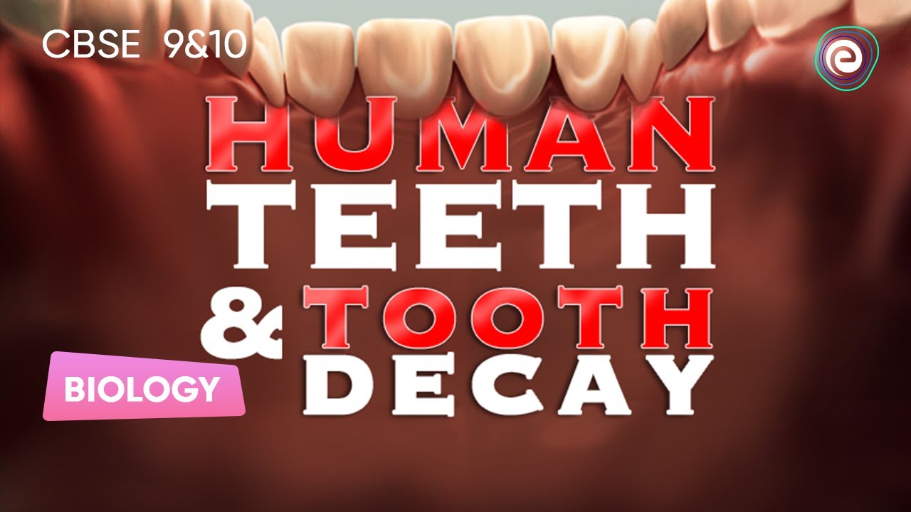 Human Teeth and Tooth Decay | Biology | CBSE Class 9&10 | Embibe ...