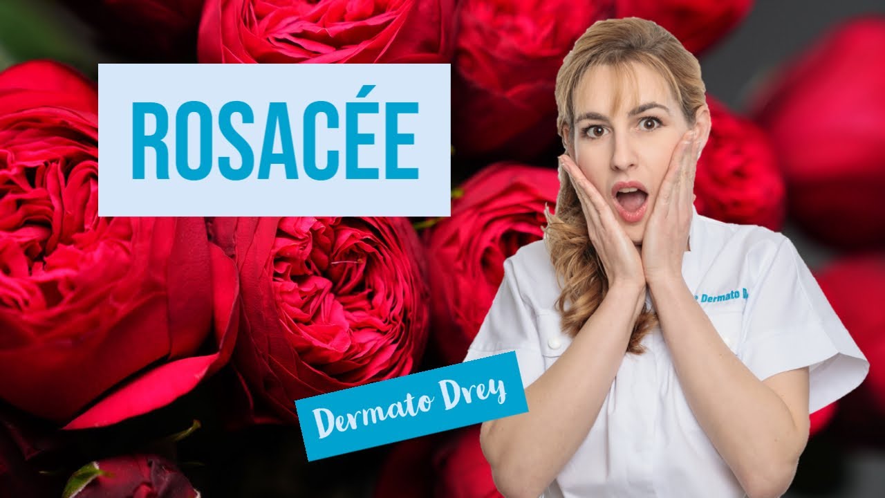 La rosacée ! Boutons et rougeurs du visage... #DermatoDrey - YouTube