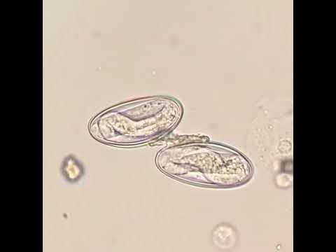 💥Huevos embrionados de Enterobius vermicularis bajo el microscopio ...