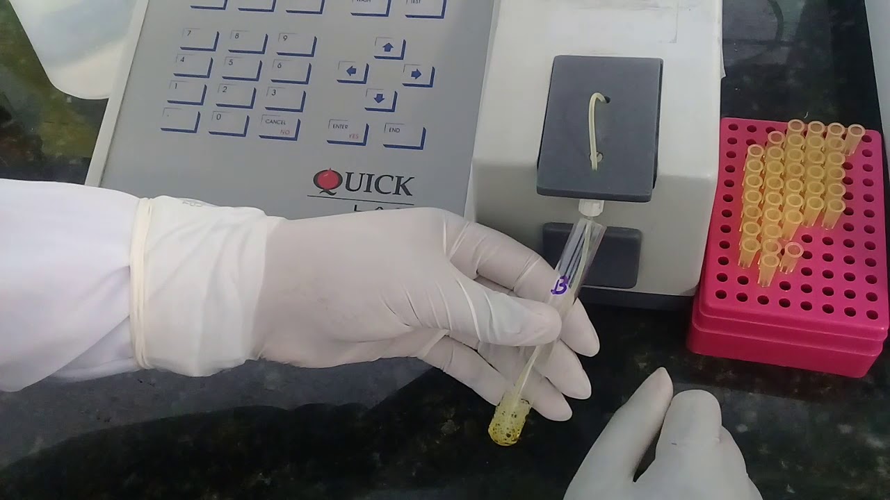 Quick Lab - YouTube